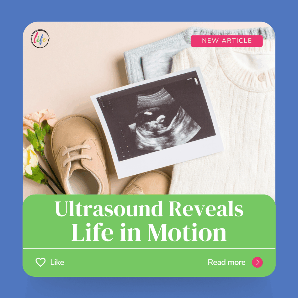 Ultrasound Reveals Life in Motion